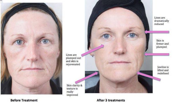 Crystal Clear “Comcit” – Qibo Schoonheidsinstituut